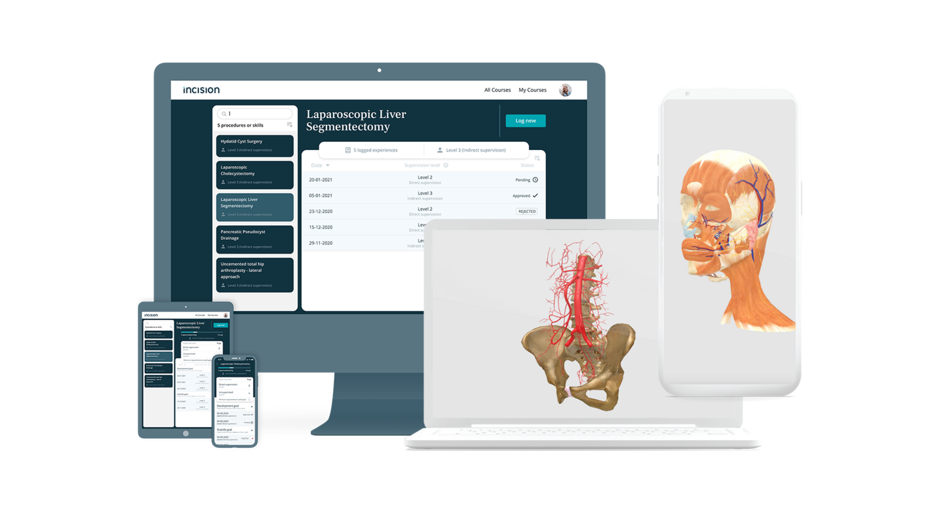 Incision Academy: sharing surgical skills