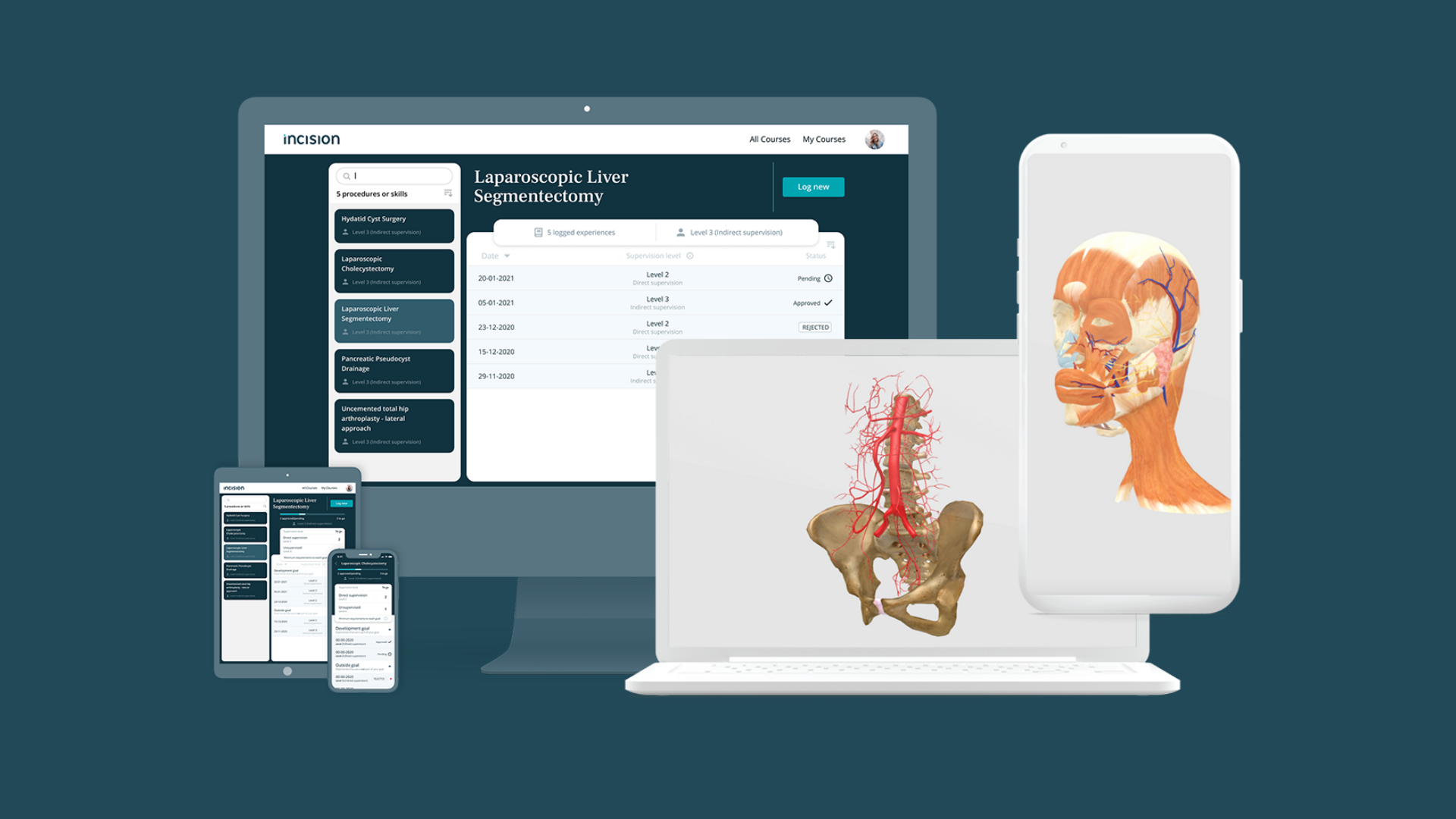 Incision Academy: sharing surgical skills